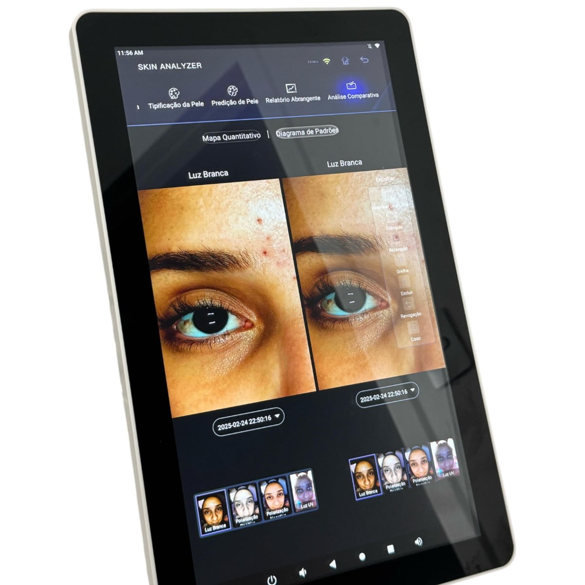 Derma Scan IA - Estek - Estek | Estética e Tecnologia | Site Oficial